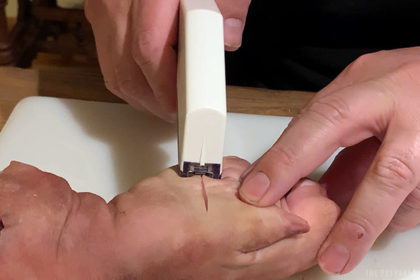 How to suture or close a wound – The Prepared